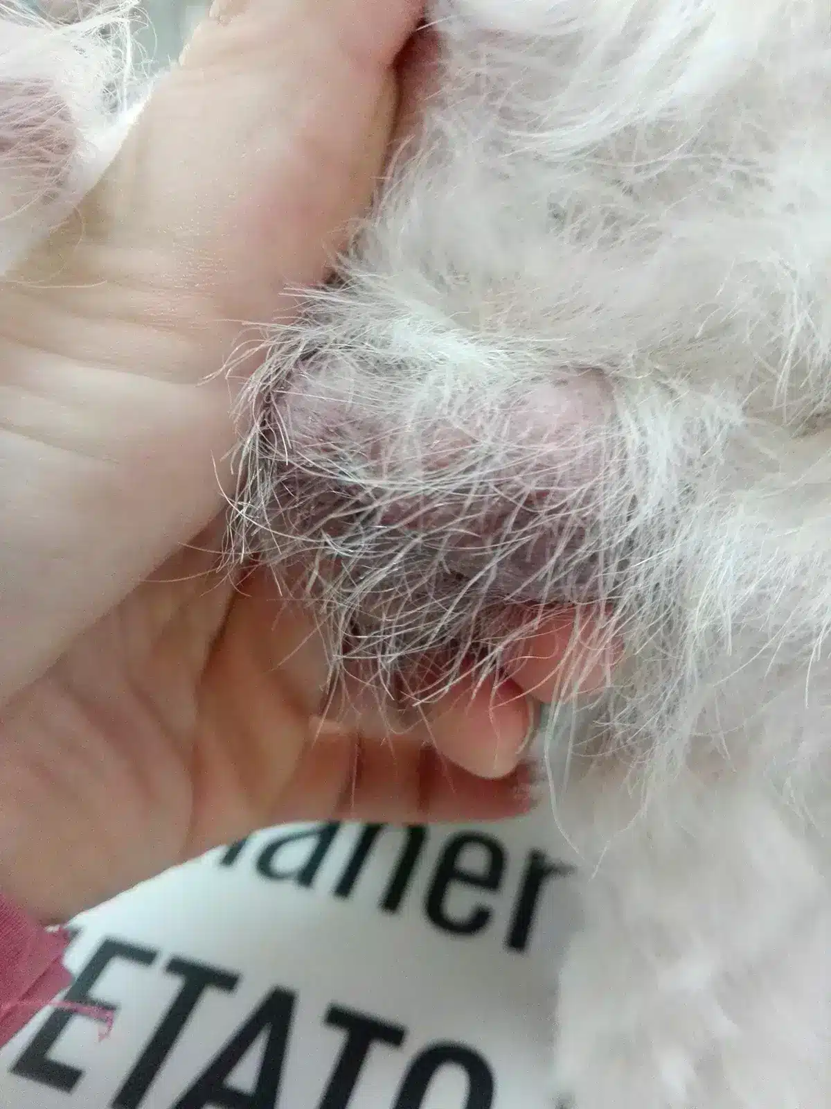 Exfoliative Dermatitis On Scrotum